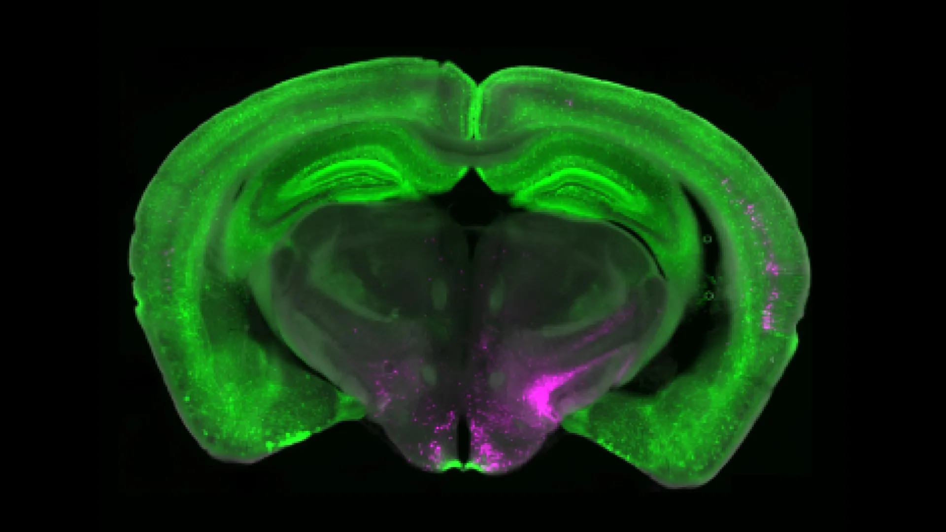 Neuroscientists Explain Why the Human Brain Cannot Feel Pain